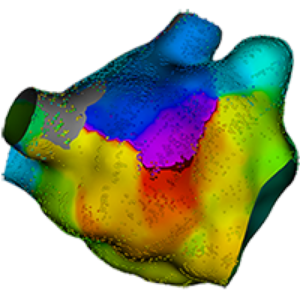 RHYTHMIA HDx™ - Mapping System - Cardioplus