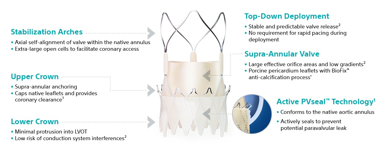 ACURATE neo2™ - Transcatheter Aortic Valve System - Cardioplus