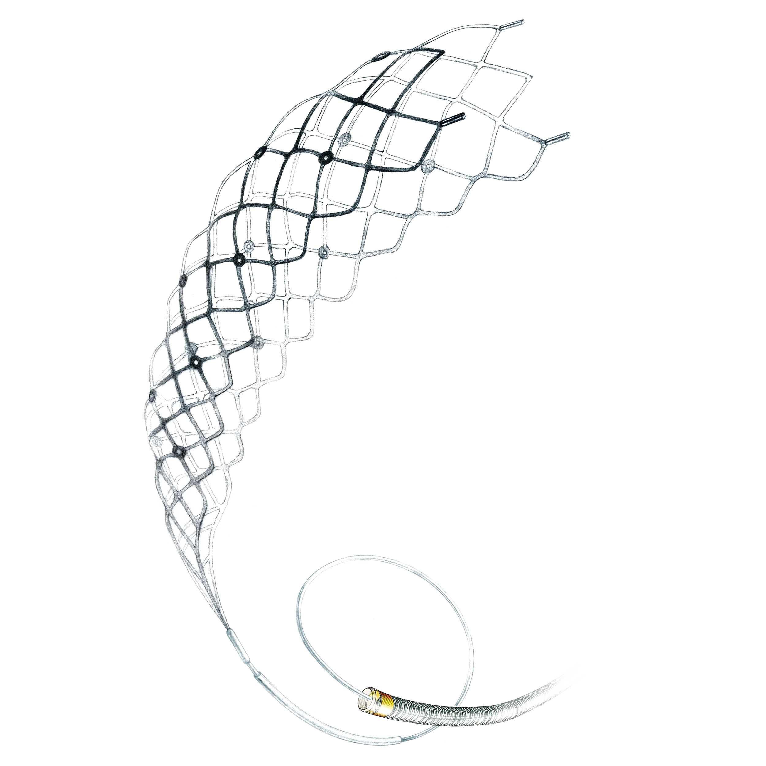 Catchview - Revascularization Device - Cardioplus