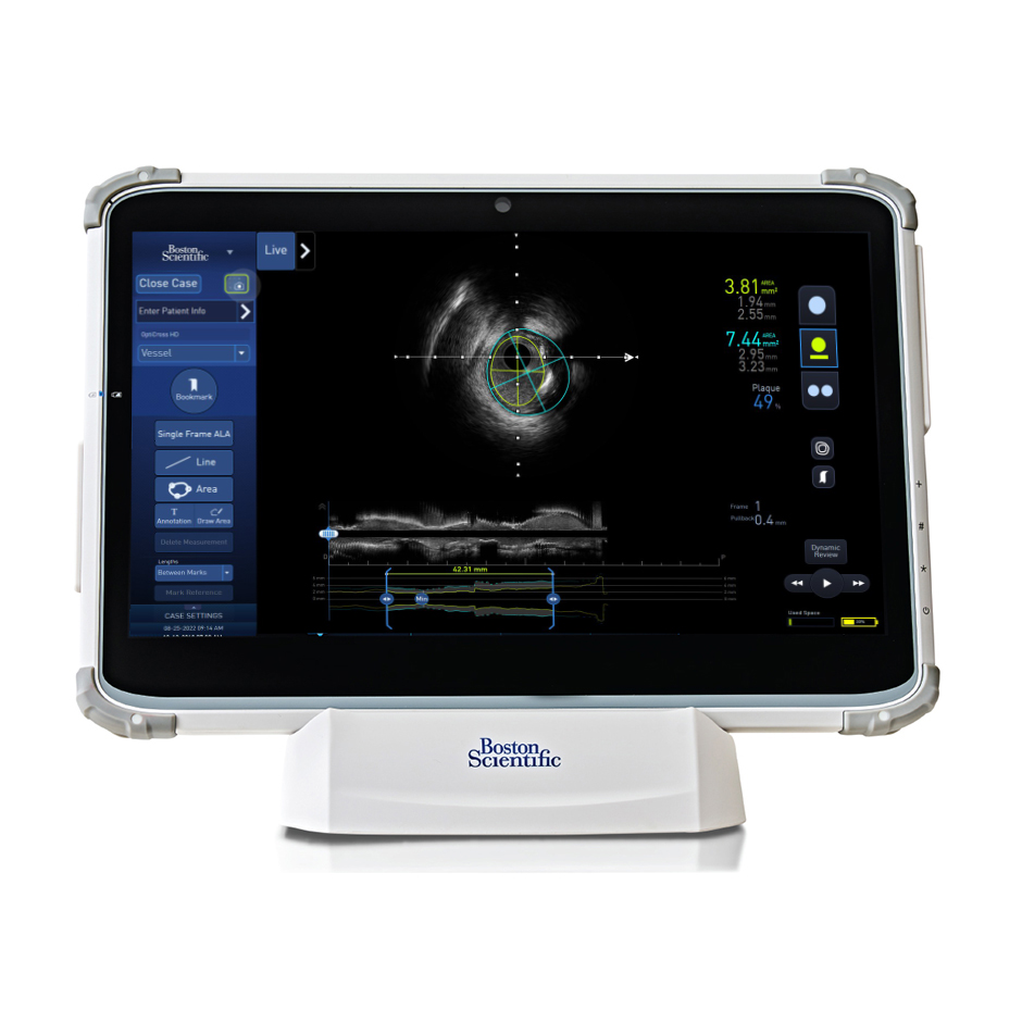 AVVIGO™ + - Multi-Modality Guidance System - Cardioplus