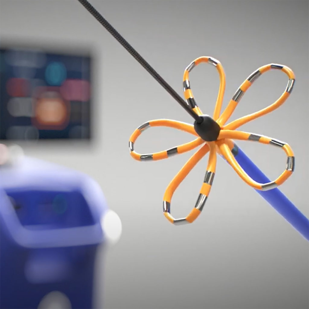 FARAPULSE™ -Pulsed Field Ablation System - Cardioplus