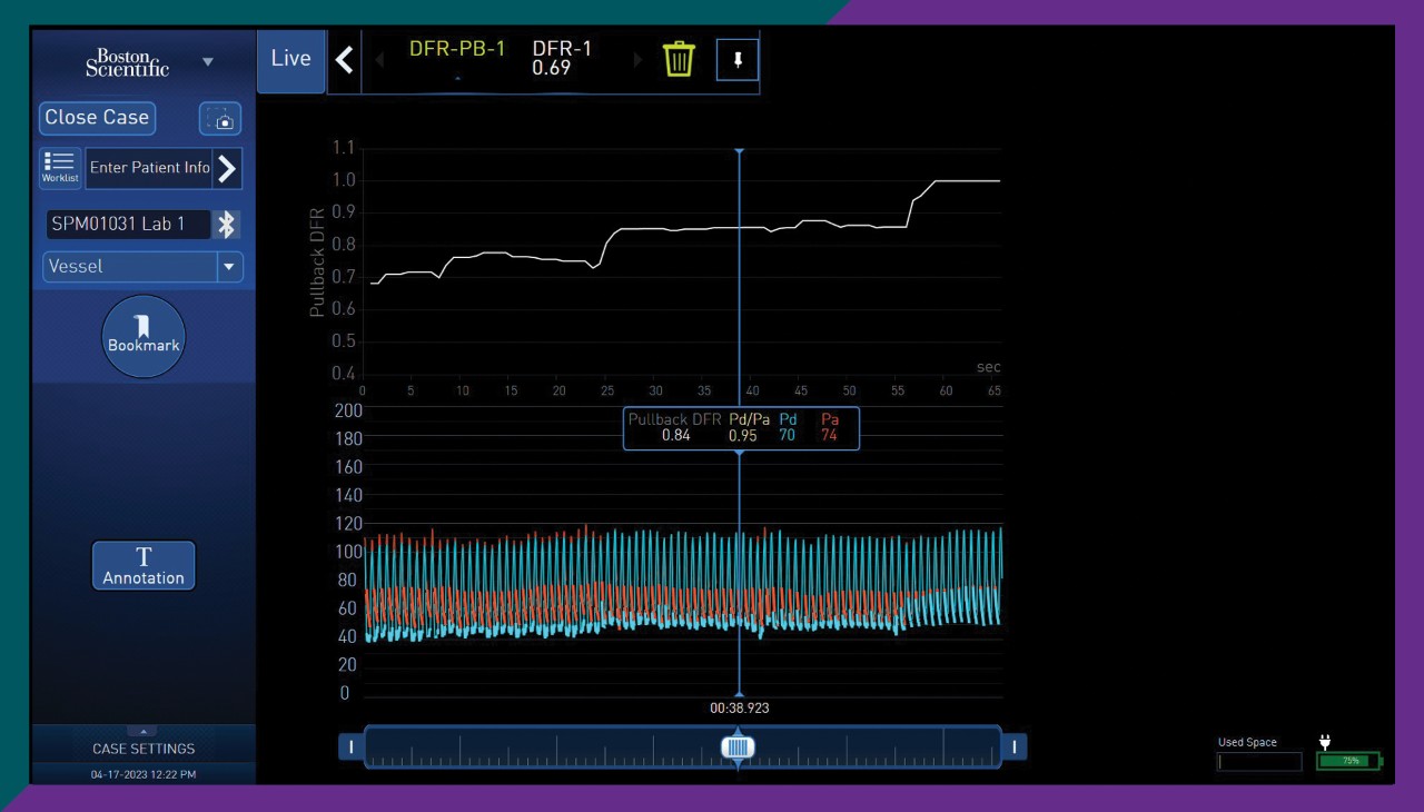 AVVIGO™ + - Multi-Modality Guidance System - Cardioplus